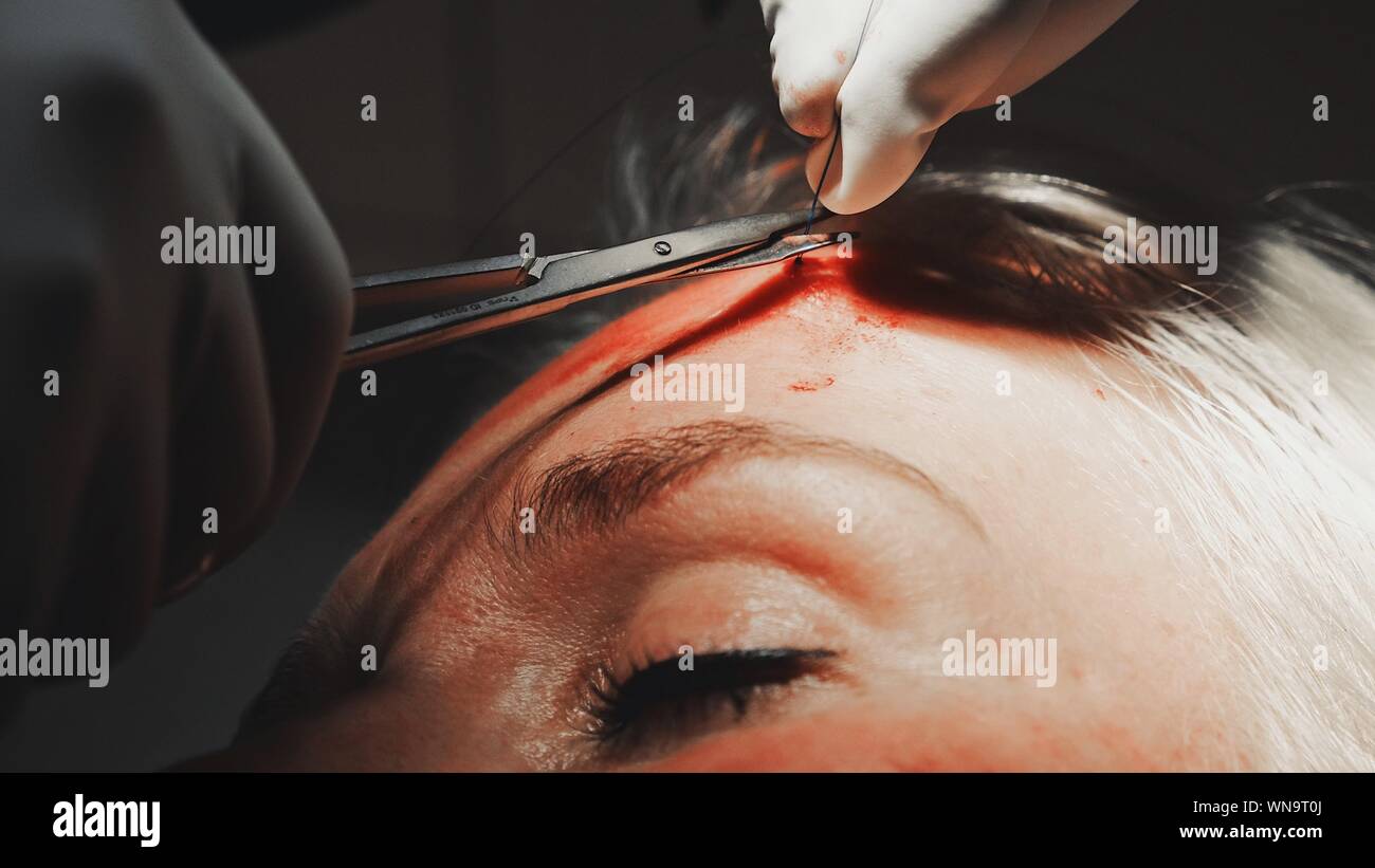 Female surgery hi-res stock photography and images - Alamy