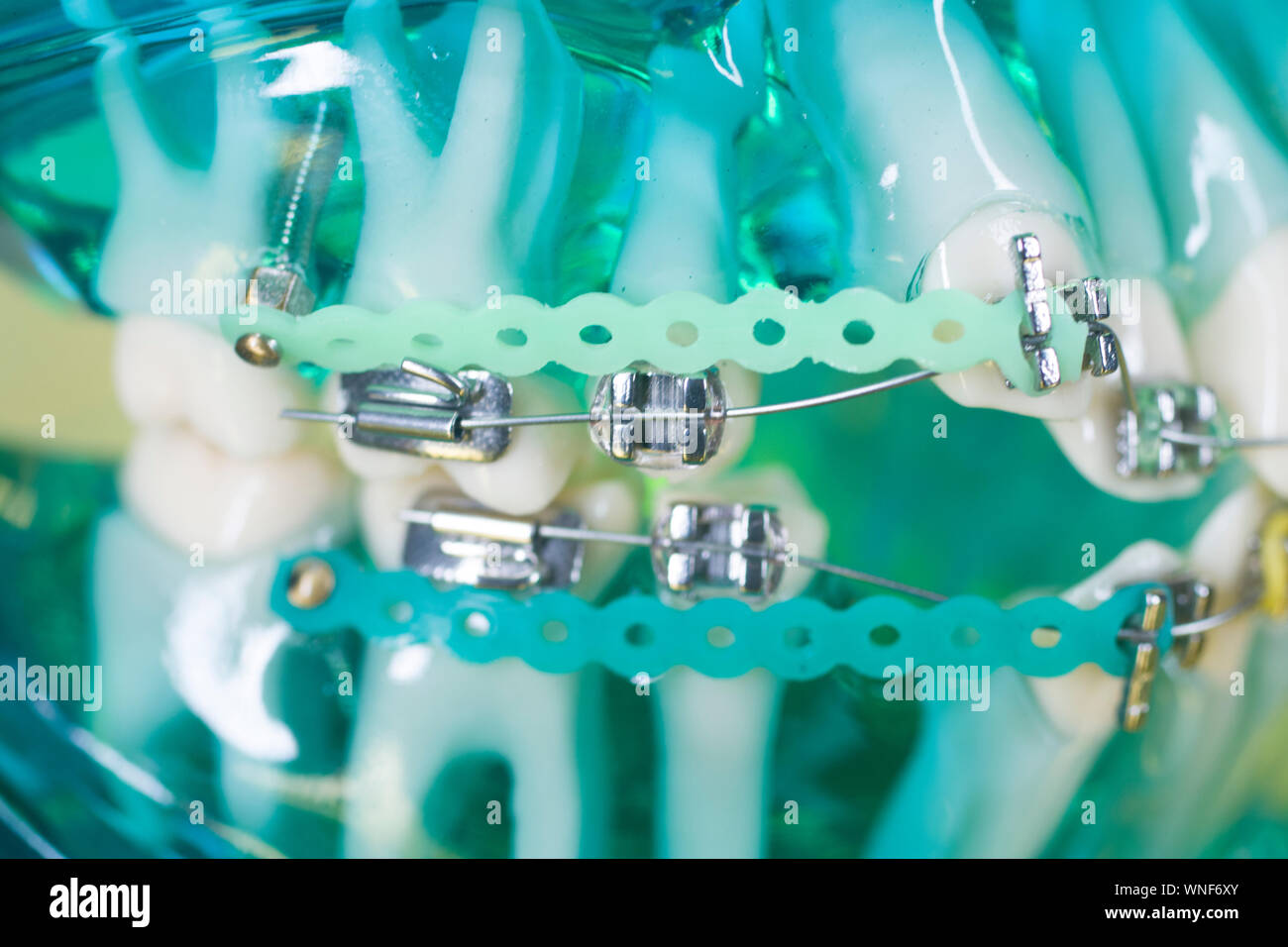 Modern metal retainers and plastic algners wire dental brackets teeth ...