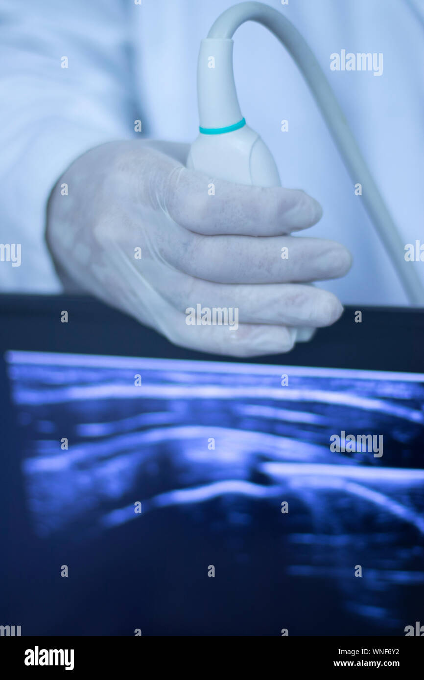 EPI Intratissue Percutaneous Electrolysis dry needling ultrasound ecography scan physiotherapy ...