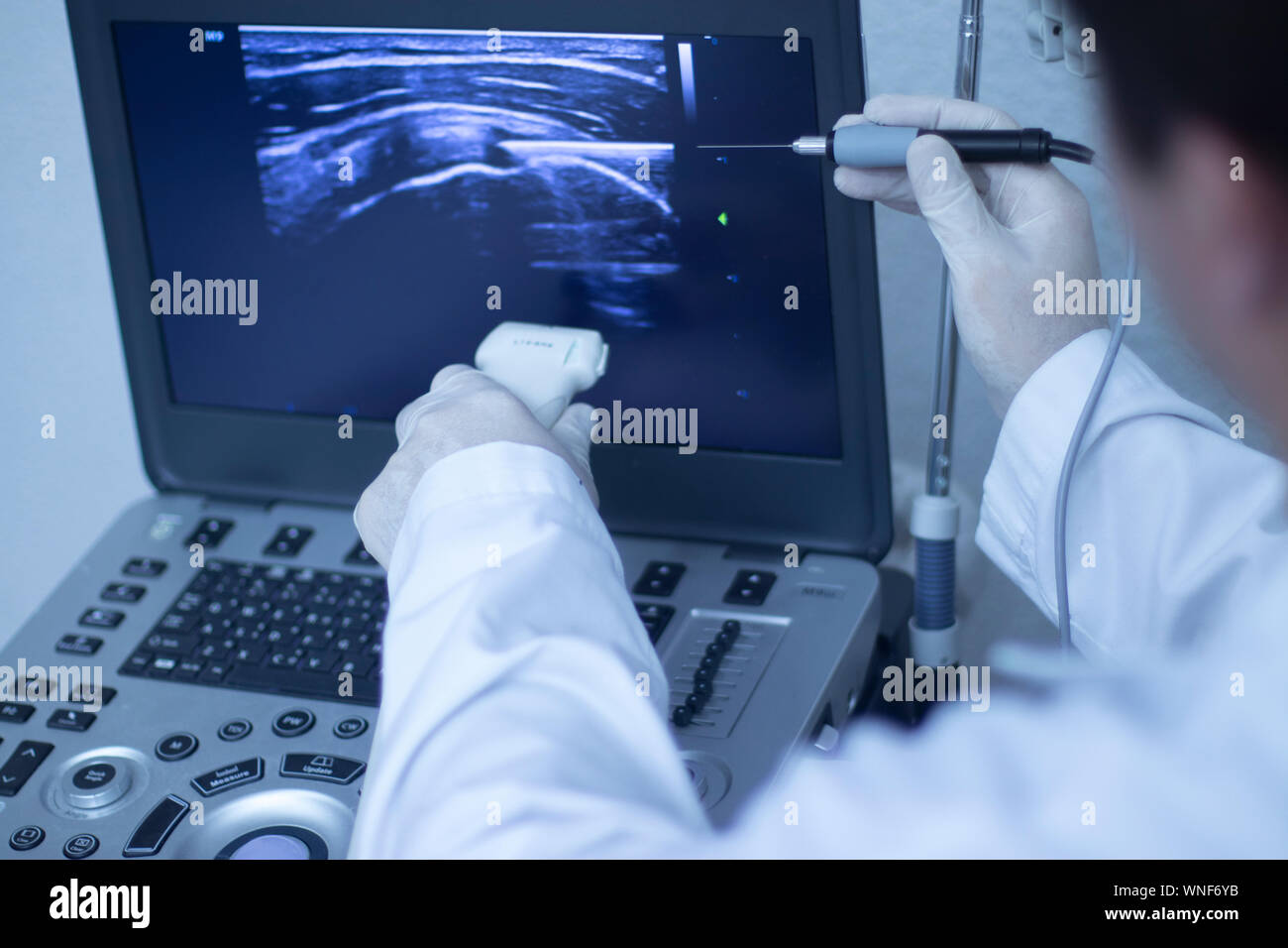 EPI Intratissue Percutaneous Electrolysis dry needling ultrasound ...