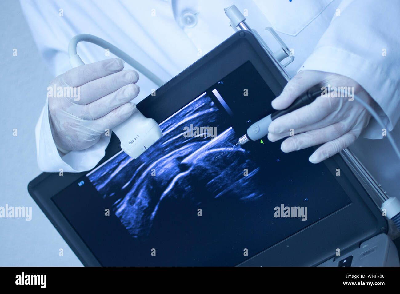 EPI Intratissue Percutaneous Electrolysis dry needling ultrasound ecography scan physiotherapy ...