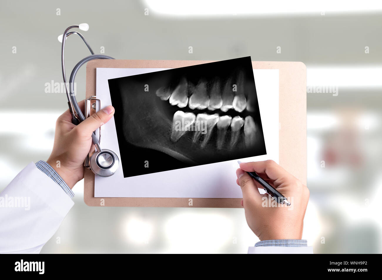 X Ray High Resolution Stock Photography and Images - Alamy
