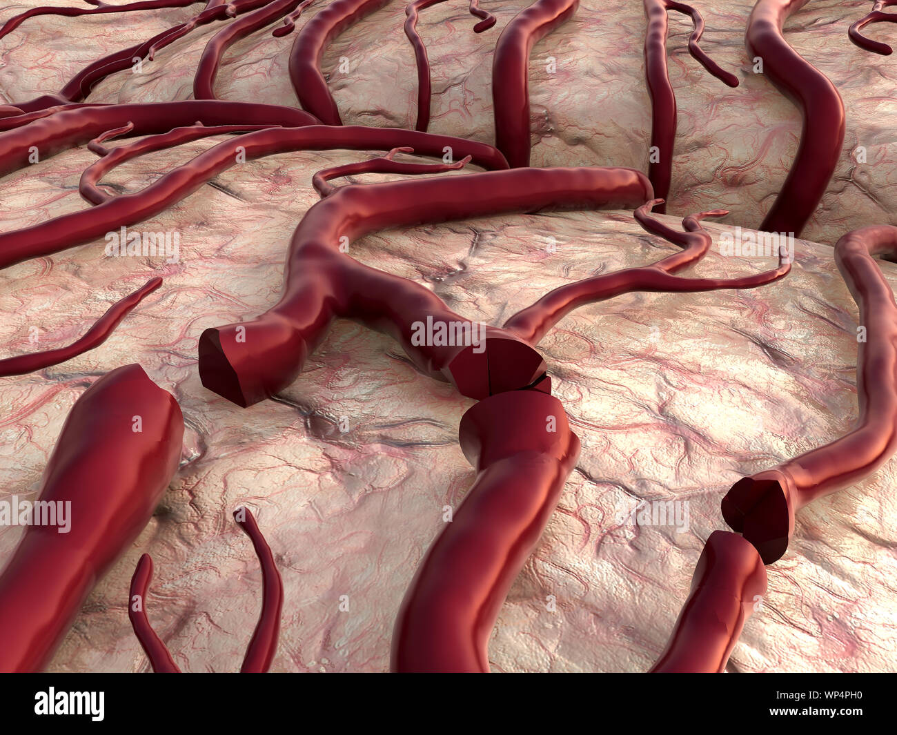 Blood loss hi-res stock photography and images - Alamy