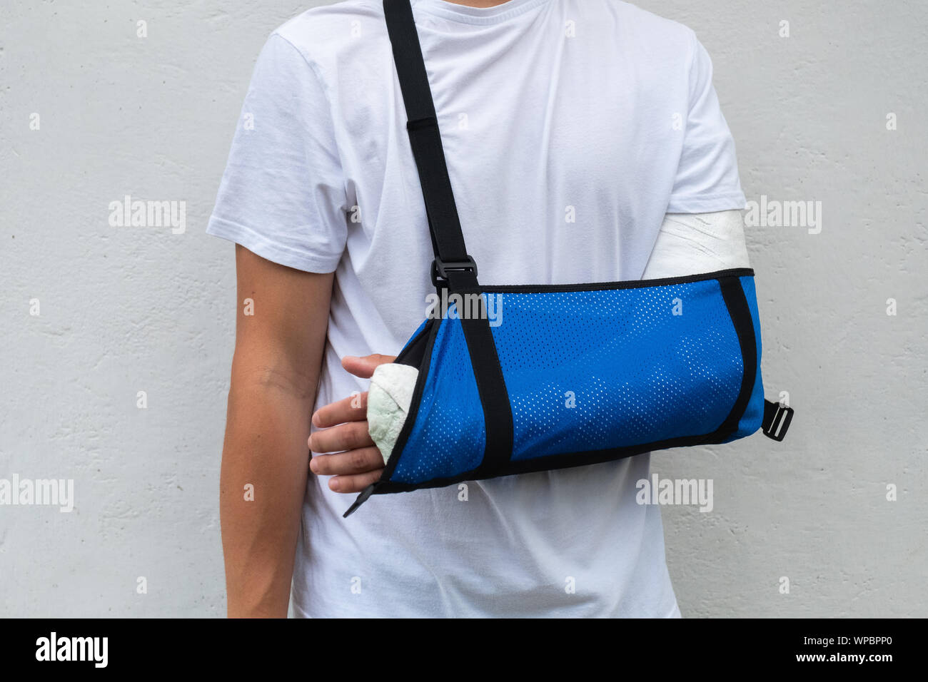 Plaster after wrist fracture hi-res stock photography and images - Alamy