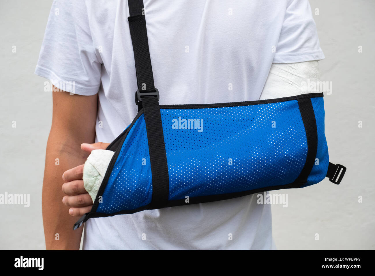 Man with broken arm wrapped medical cast plaster and blue bandage ...