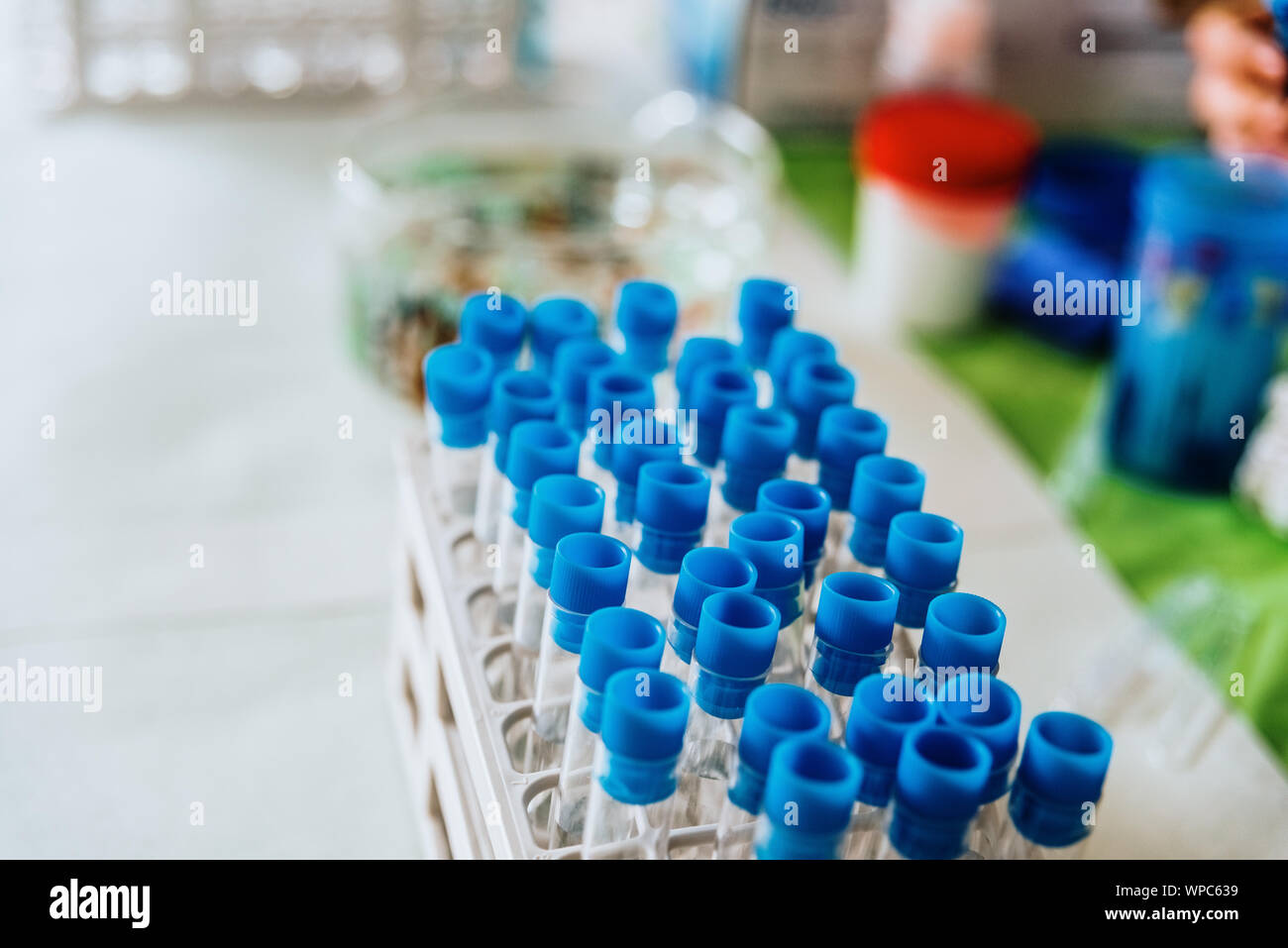 Many test tubes with blue plugs in a rack full of scientific ...