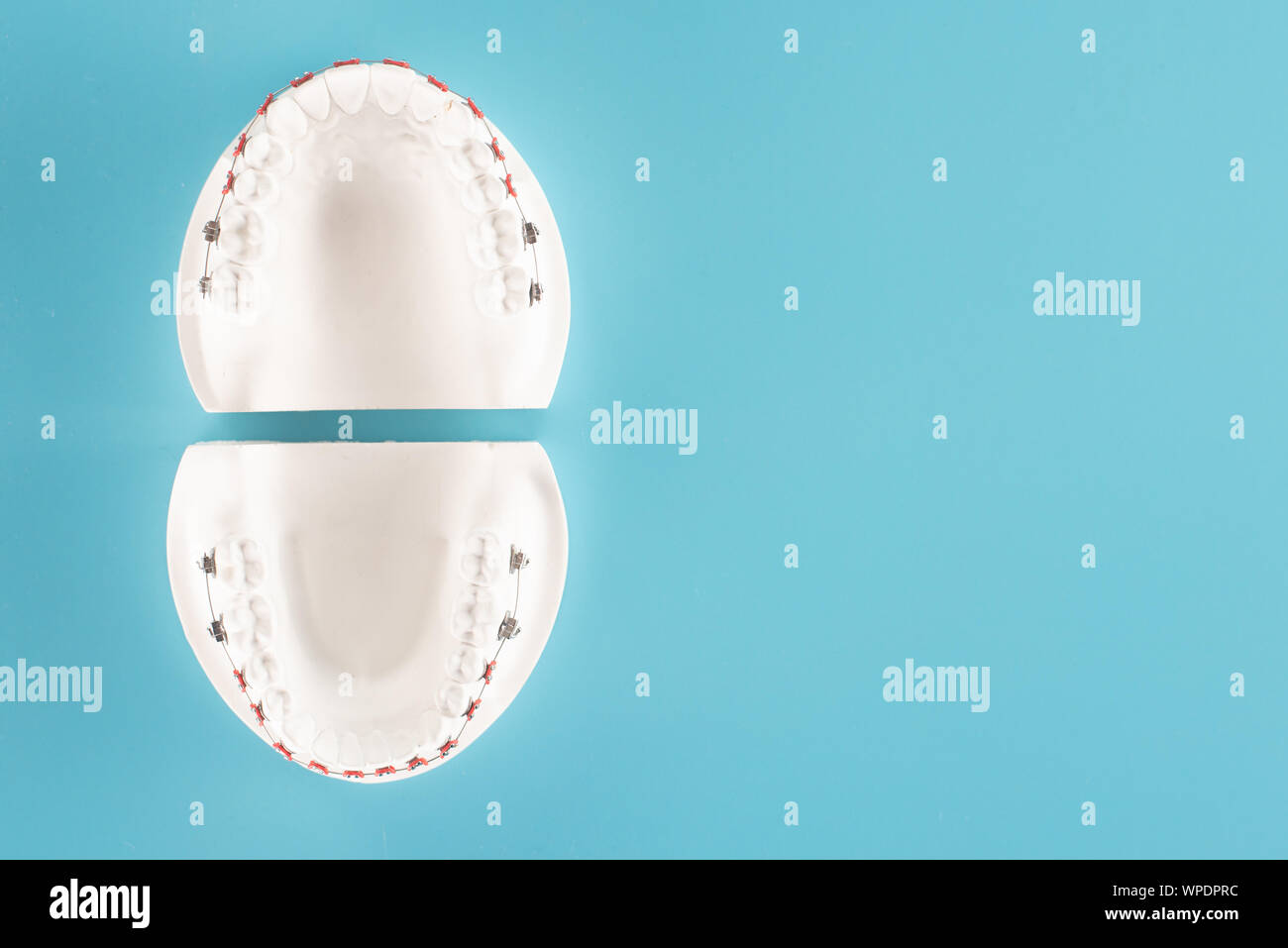 Dental braces model on blue background Stock Photo - Alamy