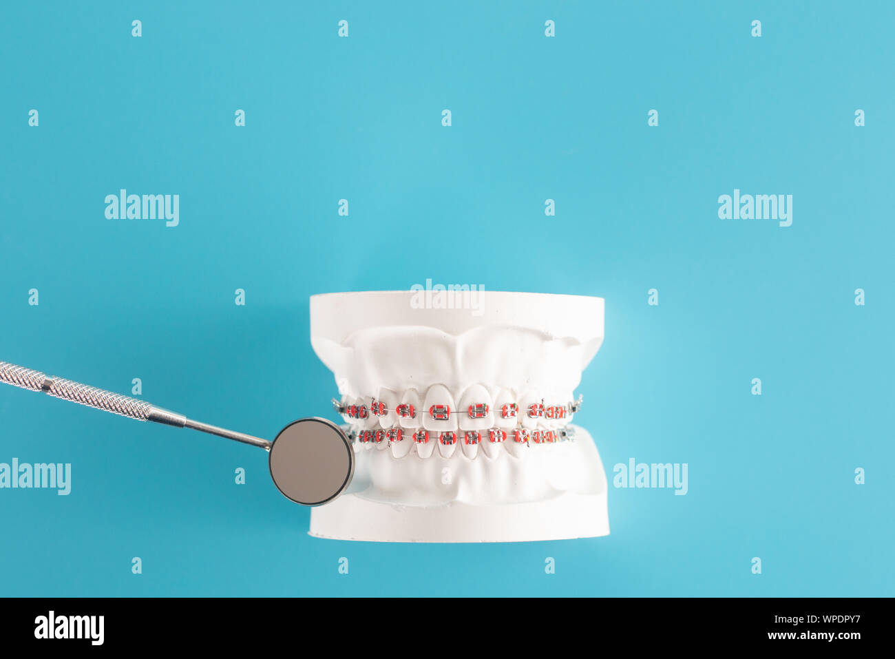Dental braces model on blue background Stock Photo - Alamy