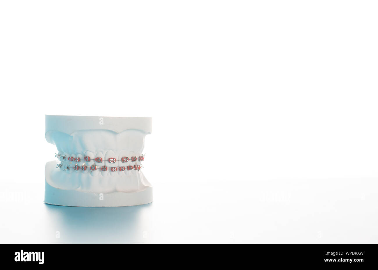 Dental braces model on white background Stock Photo - Alamy