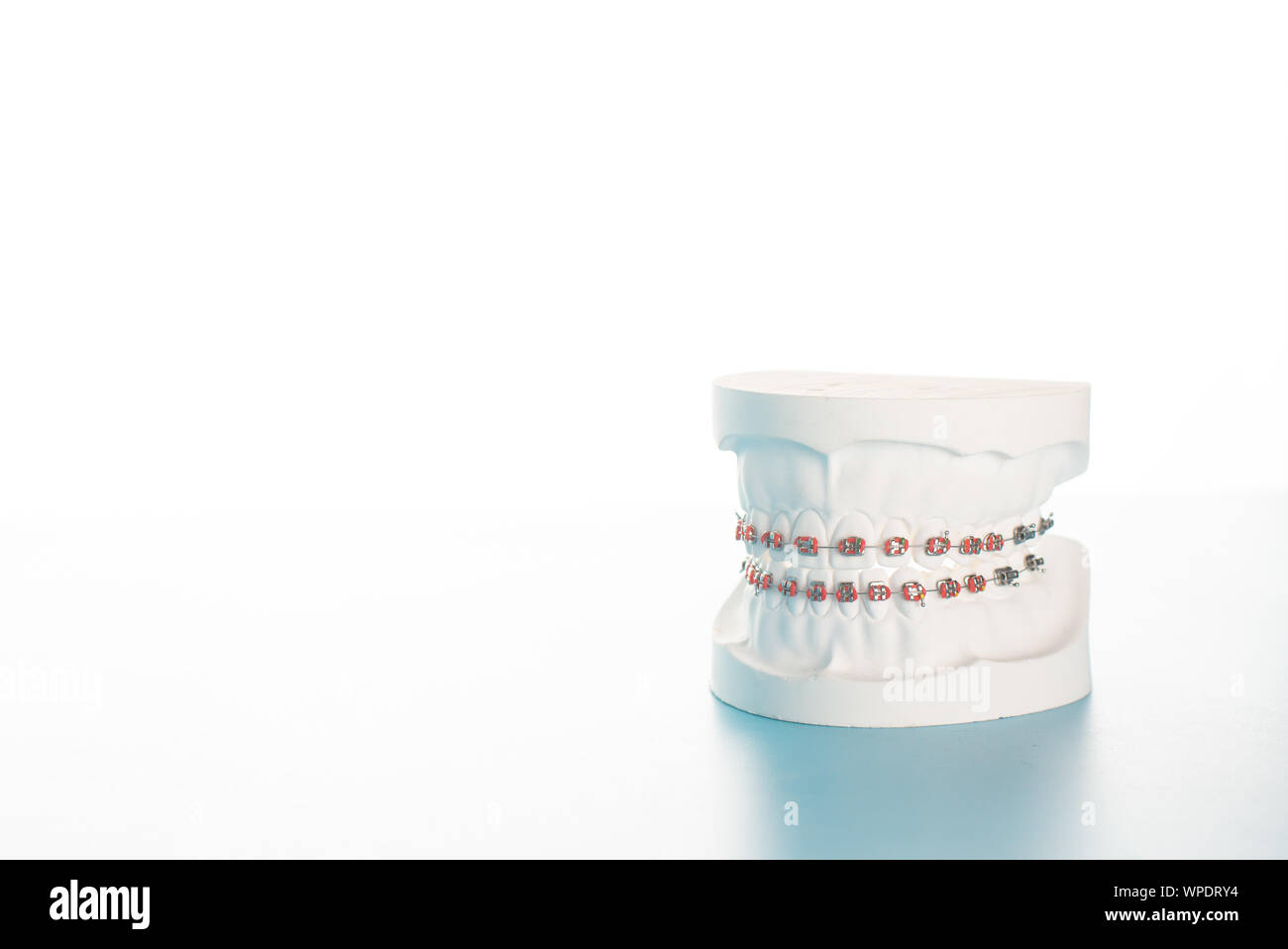 Dental braces model on white background Stock Photo - Alamy