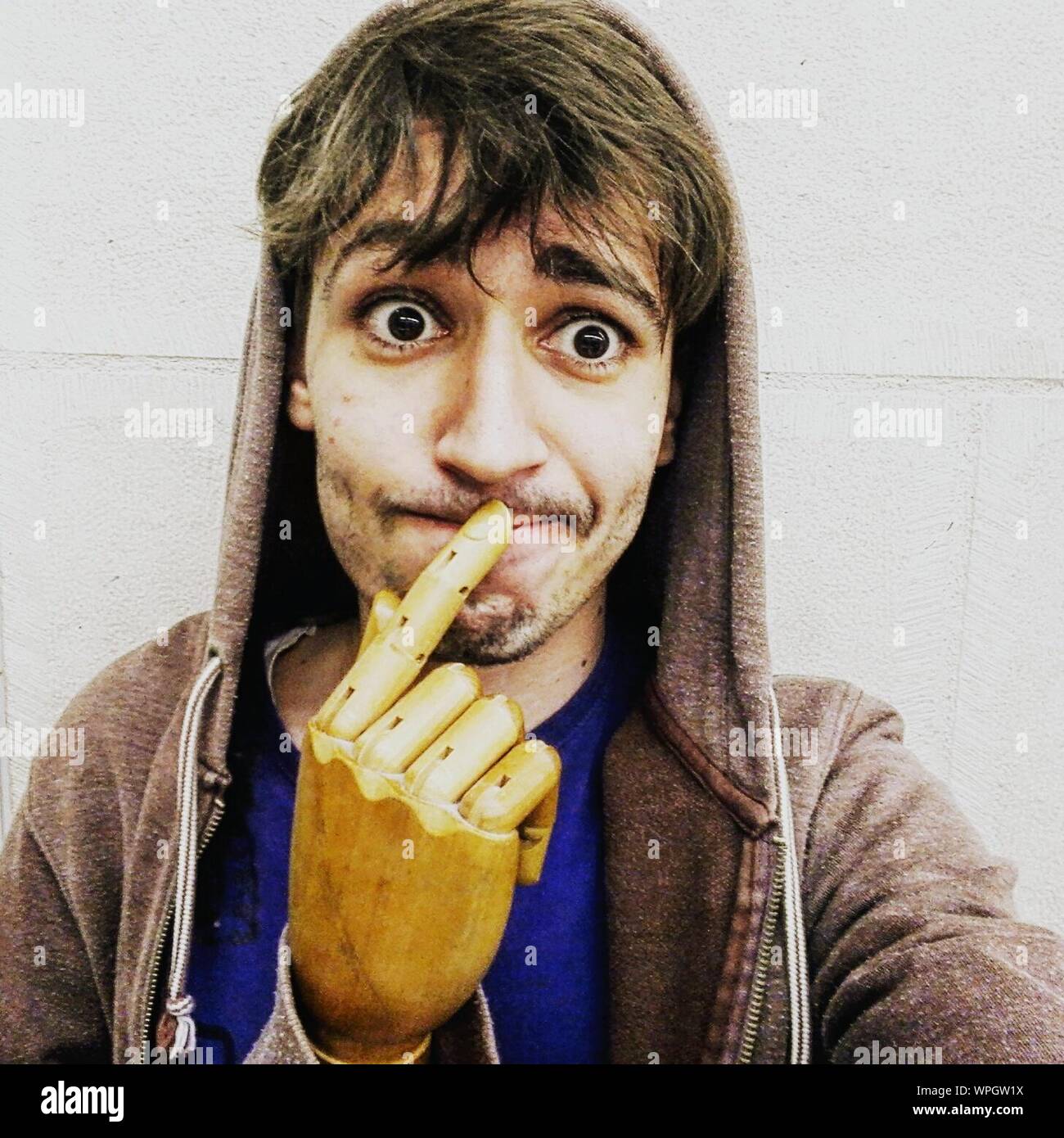 Prosthetic hand people hi-res stock photography and images - Alamy