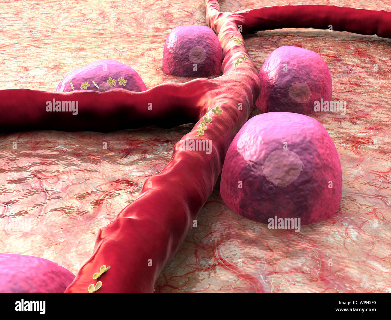 blood vessel, Beta cells, autoimmune disease, Beta cells produces ...