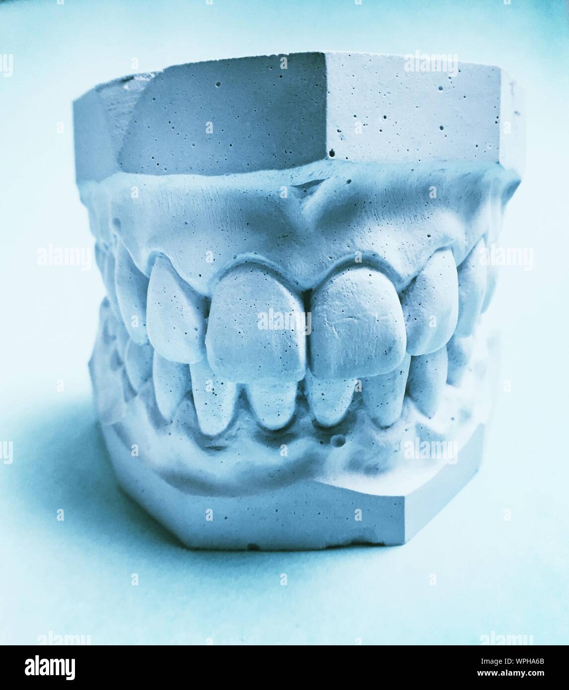 Teeth mold hi-res stock photography and images - Alamy