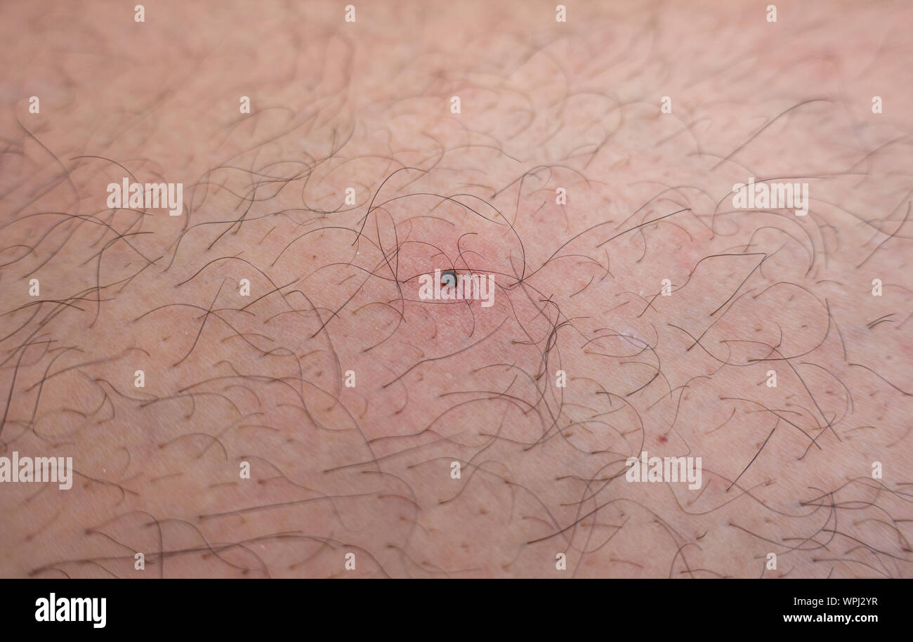 Hairy man leg hi-res stock photography and images - Alamy