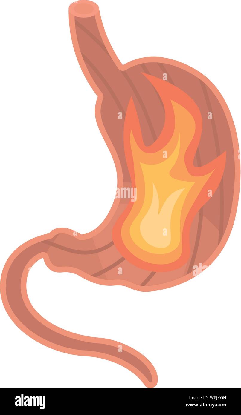 Chronic and acute gastritis hi-res stock photography and images - Alamy