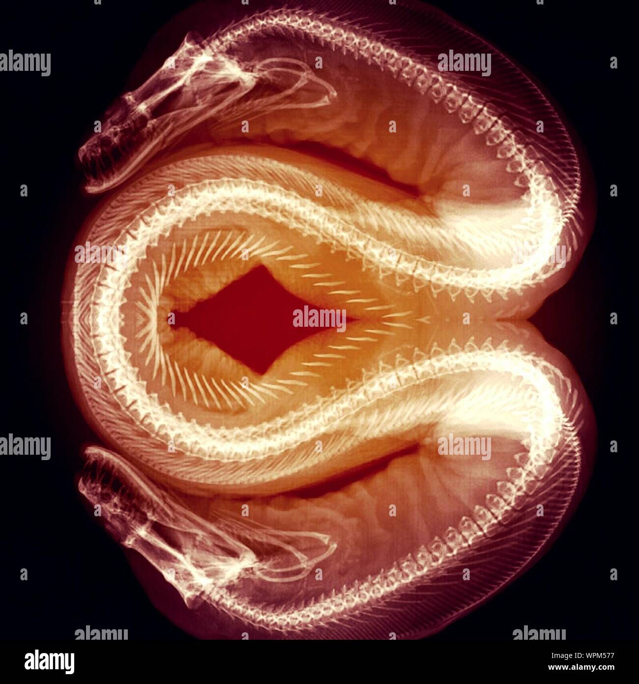 X ray image hi-res stock photography and images - Alamy