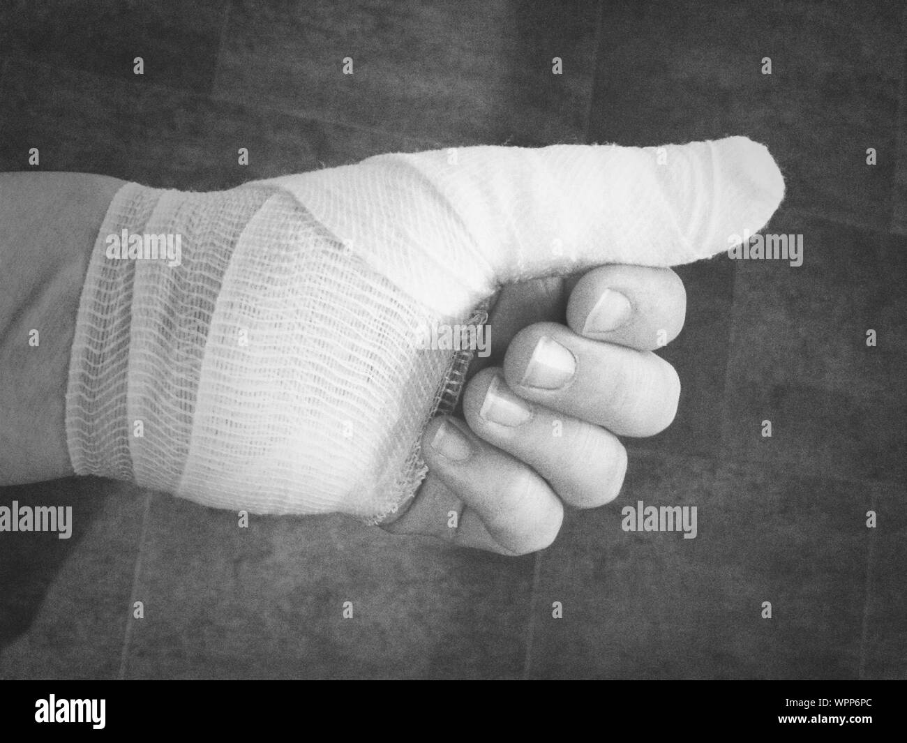 Bandaged up hand Black and White Stock Photos & Images - Alamy