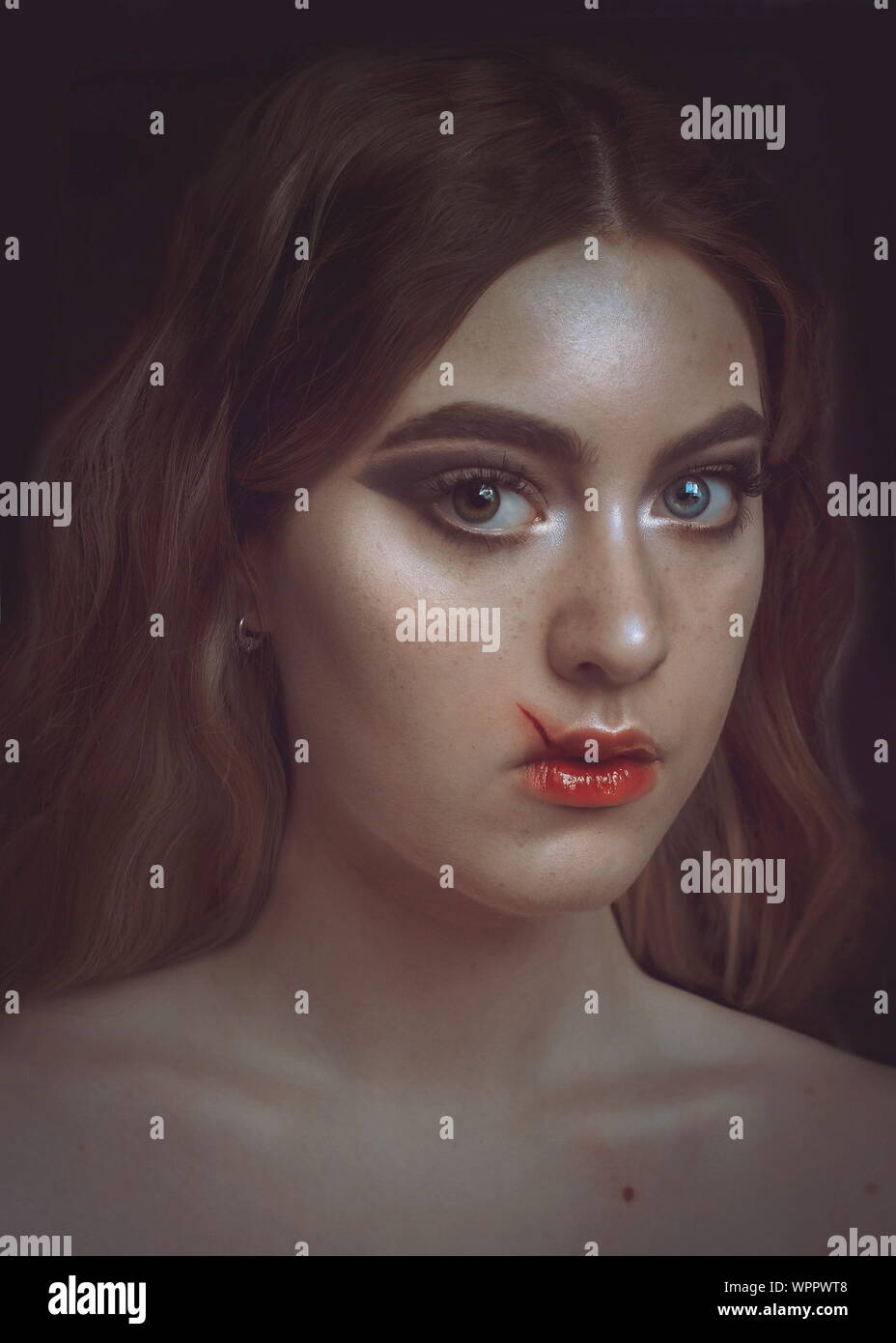 Injured lip hi-res stock photography and images - Alamy