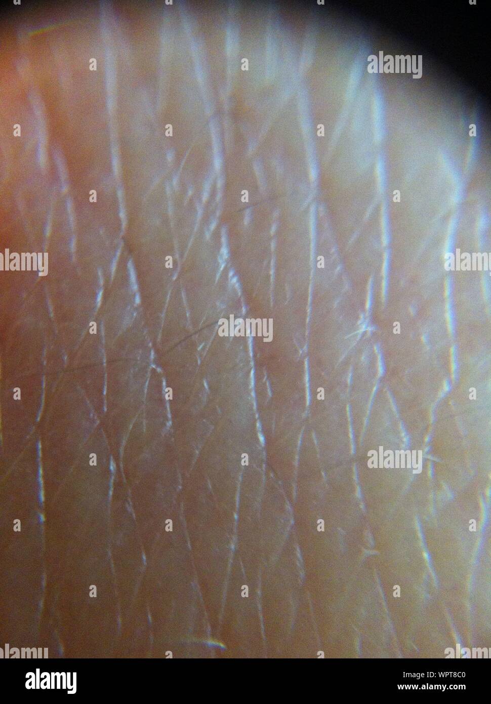 Human skin macro hair hi-res stock photography and images - Alamy