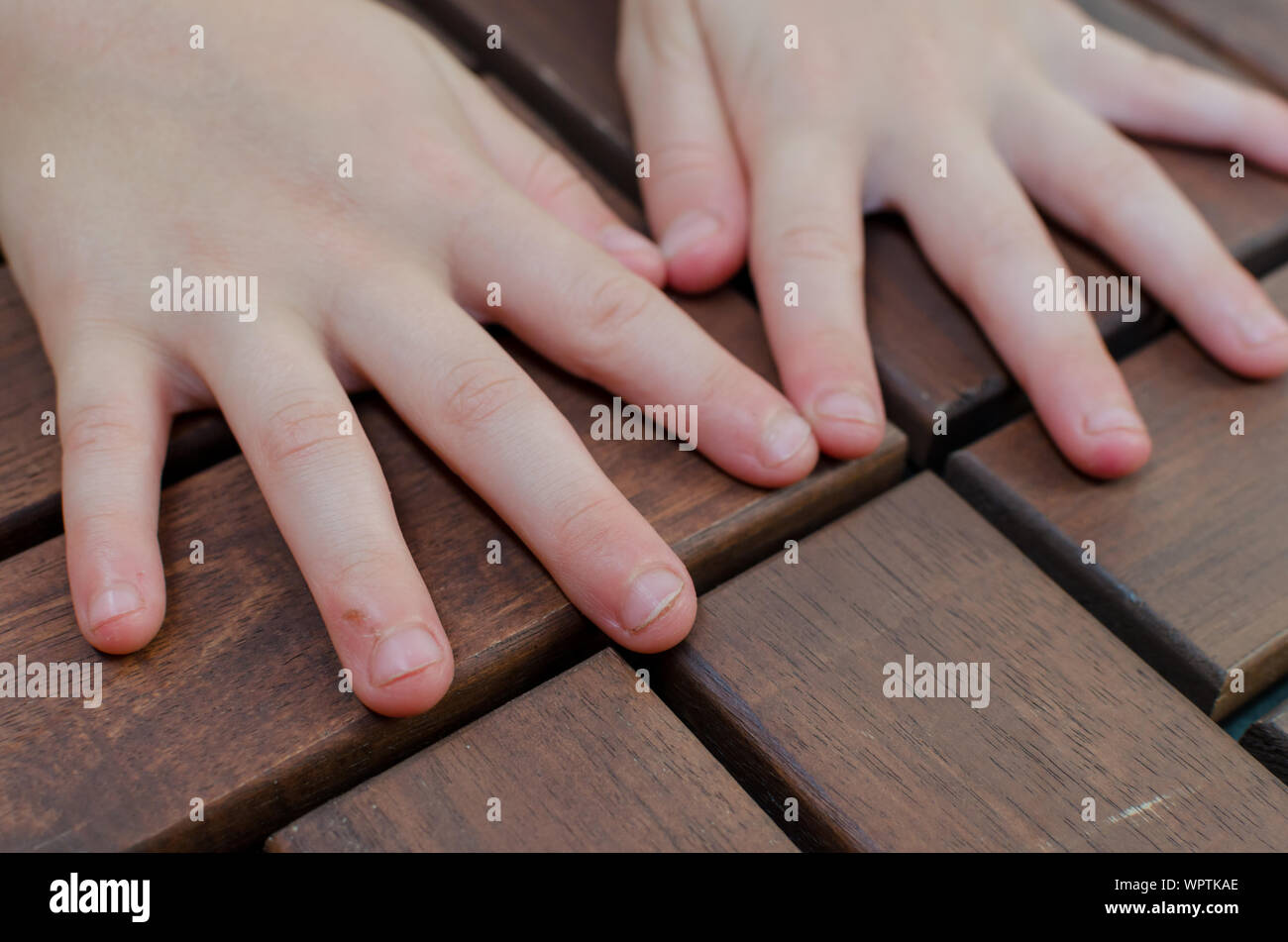 Close up of hand with bitten finger and fingernails Stock Photo - Alamy