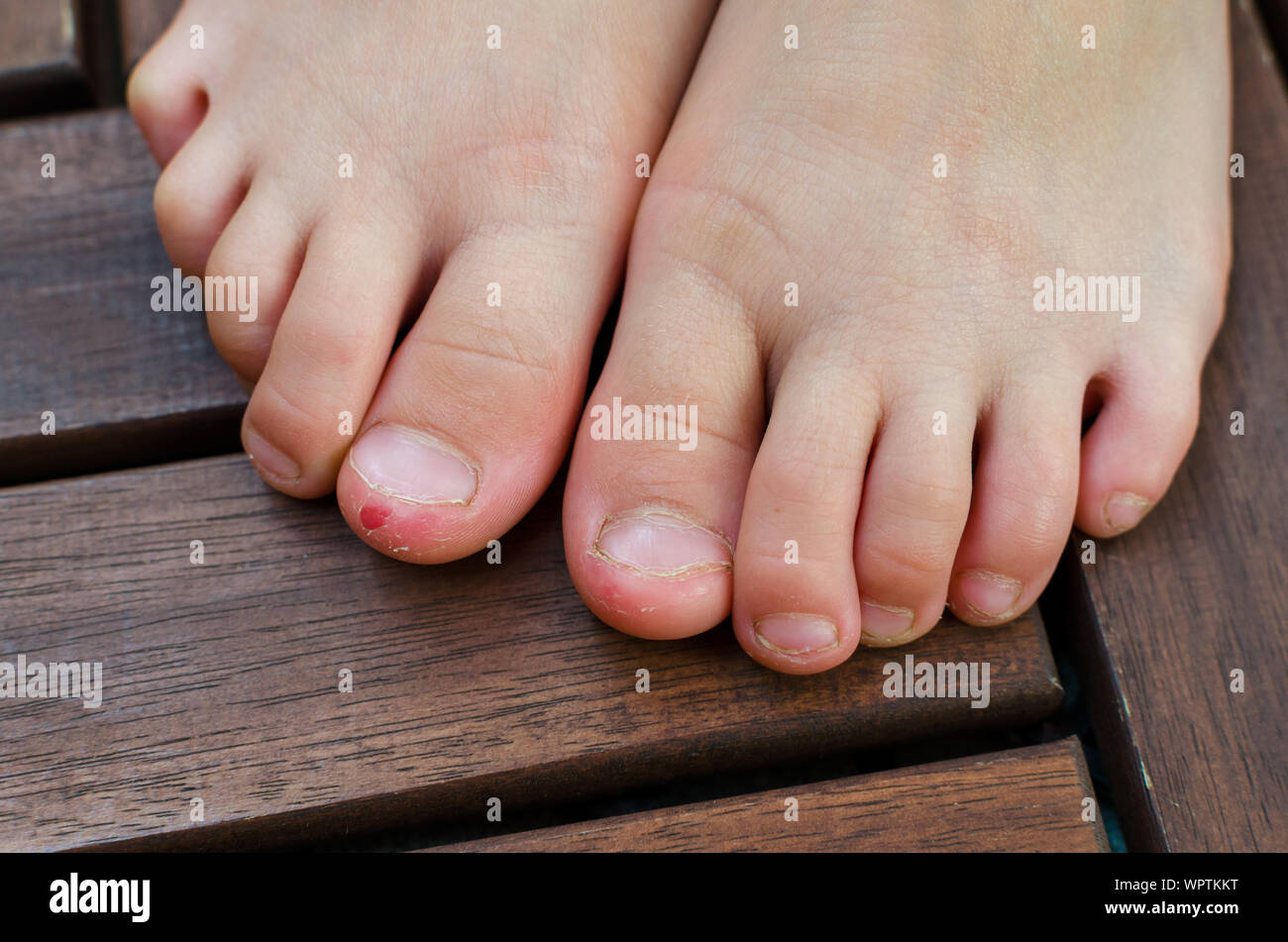 Biting nail not woman hi-res stock photography and images - Alamy