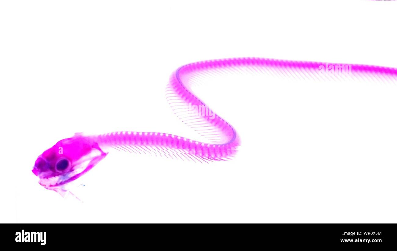 X ray image hi-res stock photography and images - Alamy