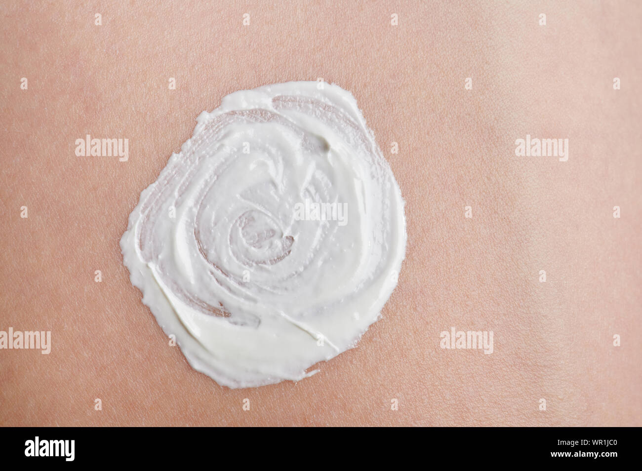 White skin cream spot on face macro close up view Stock Photo - Alamy