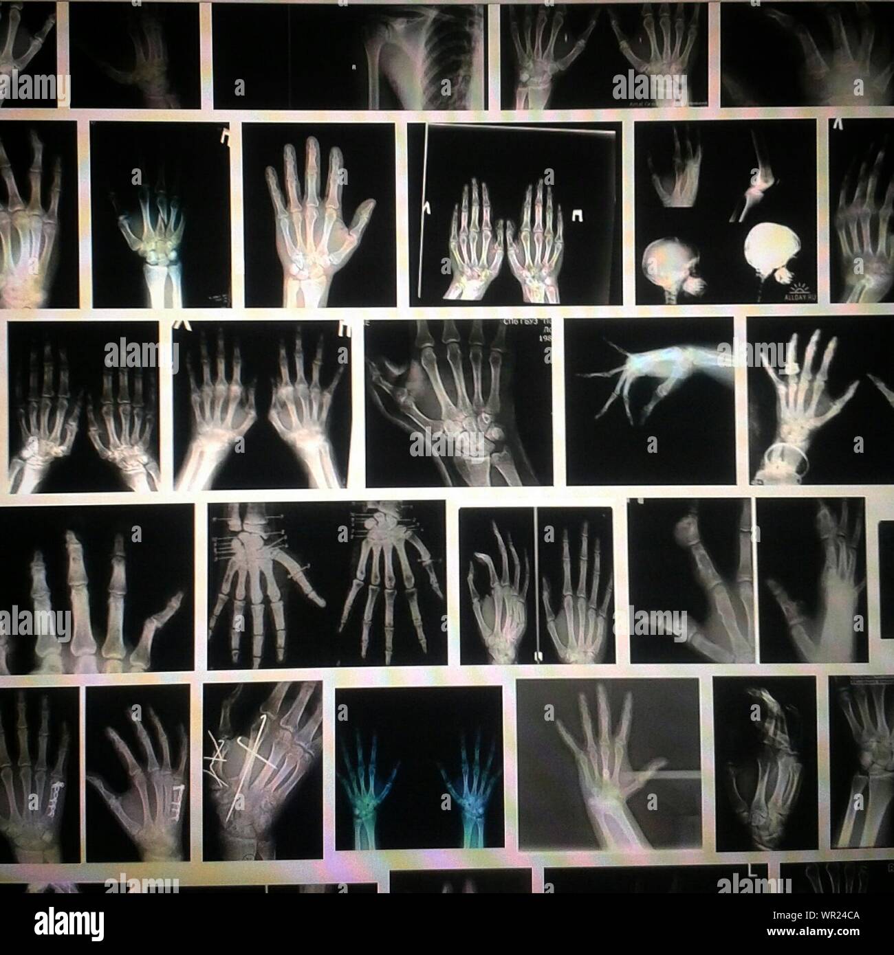 X ray pattern hi-res stock photography and images - Alamy