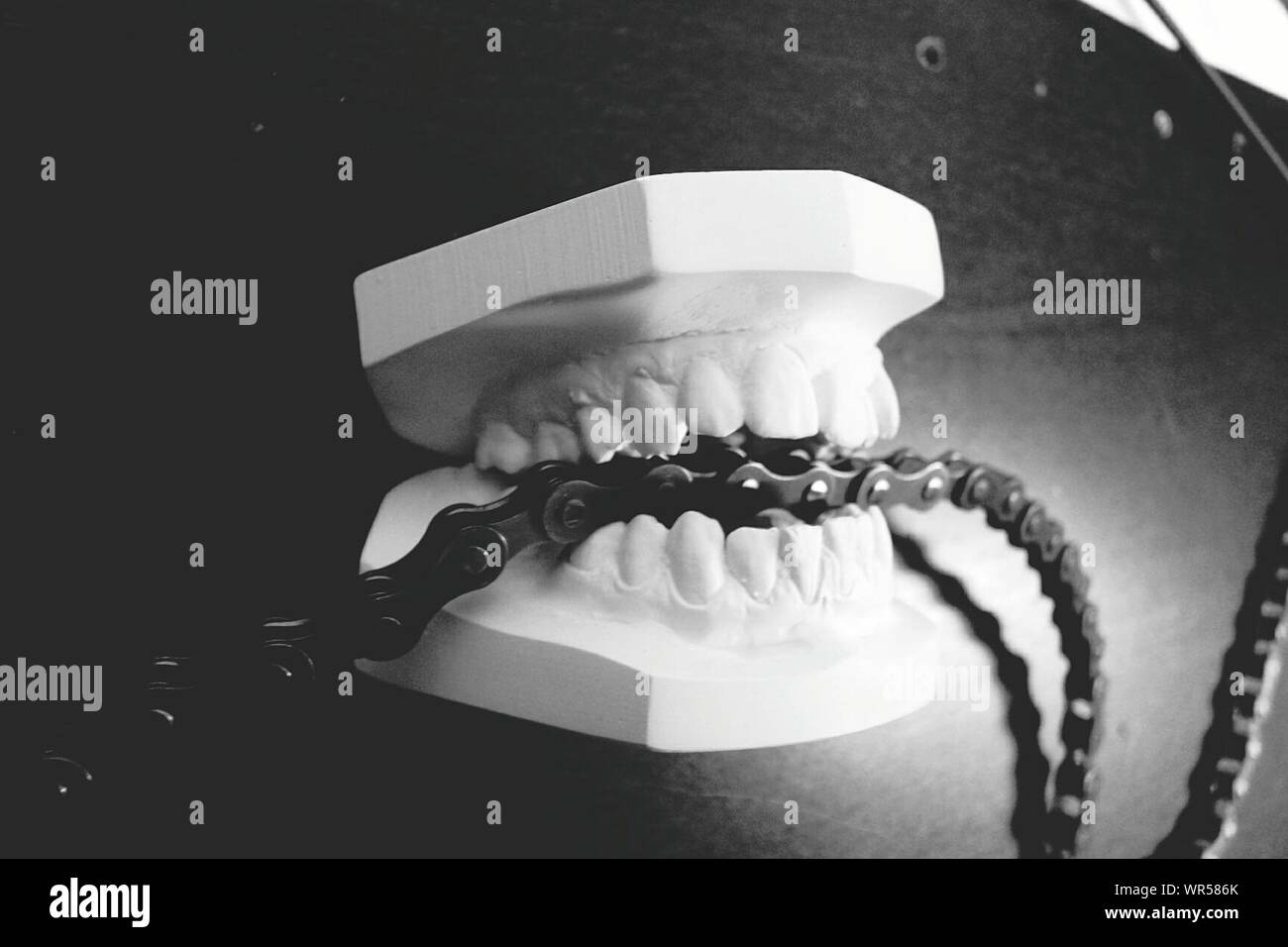 Dental mold hi-res stock photography and images - Alamy