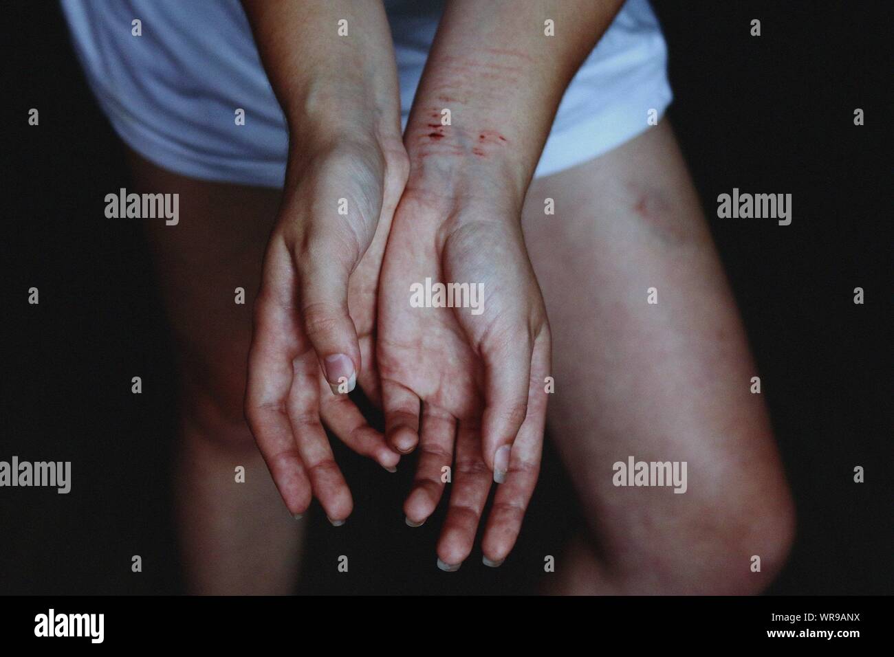 Beaten up person hi-res stock photography and images - Alamy