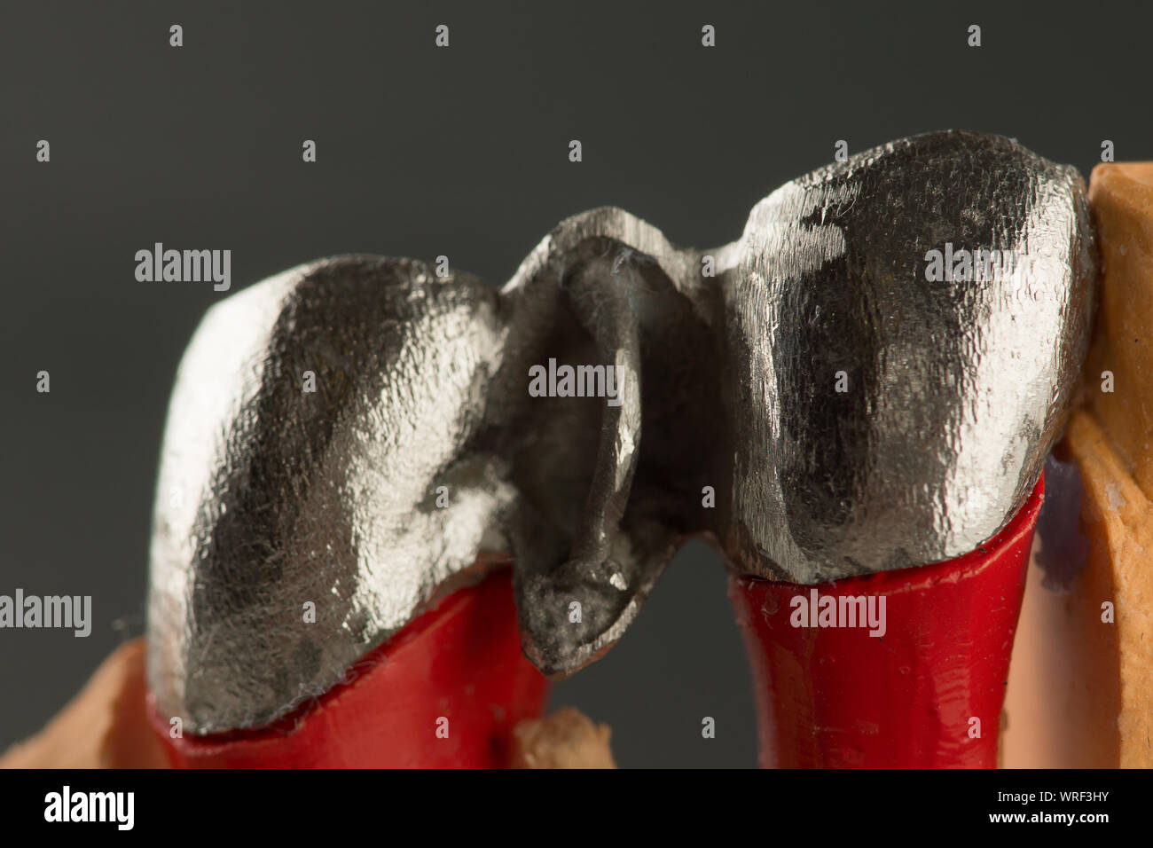 Steel artificial dental bridge for dentition restoration Stock Photo ...