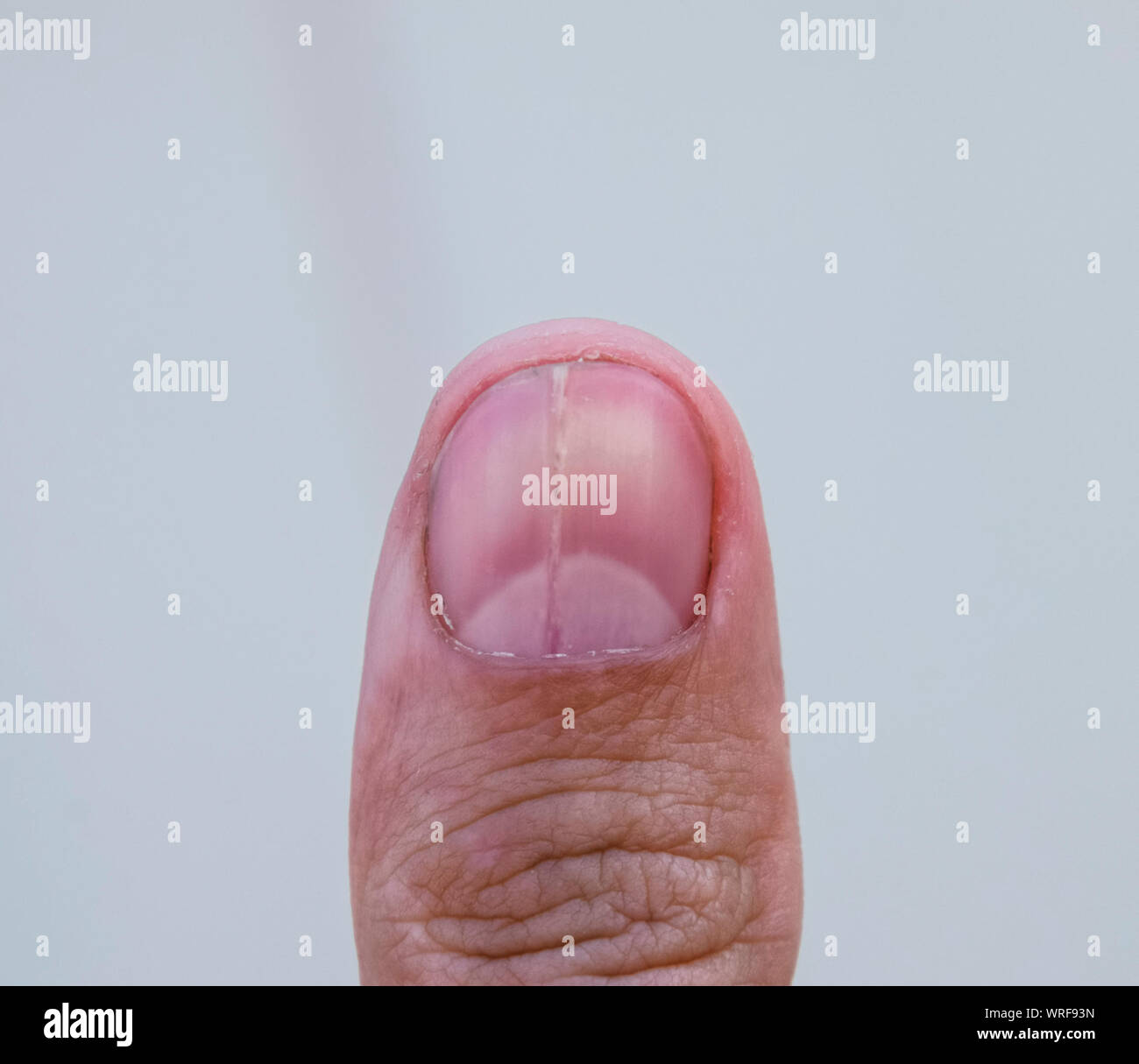 Close-up Of Finger Against White Background Stock Photo - Alamy