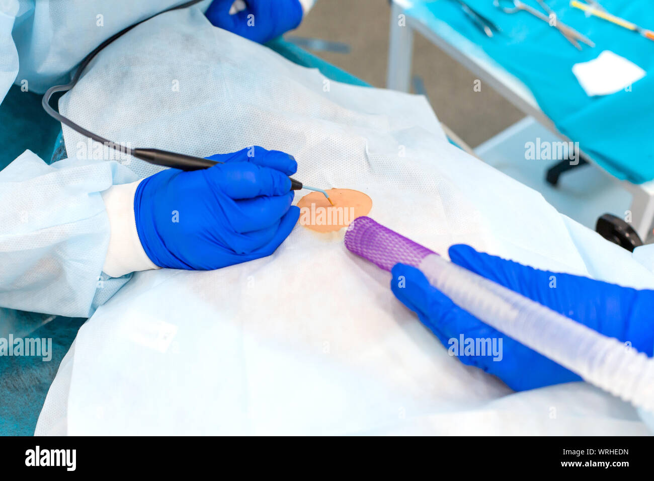 The surgeon does surgery to remove the mole on the patient's back. The ...