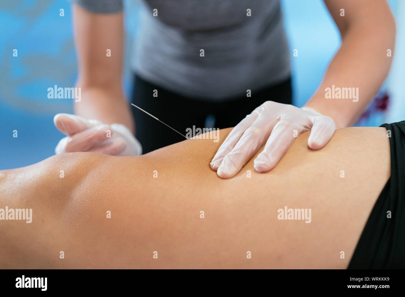 Detail of a small needle in the quadriceps leg of a patient with hands ...