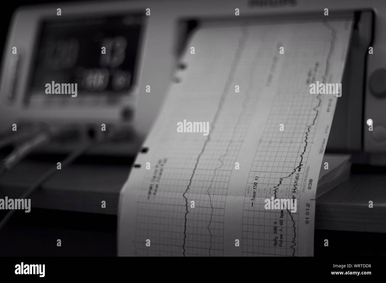 Cardiotocograph hi-res stock photography and images - Alamy