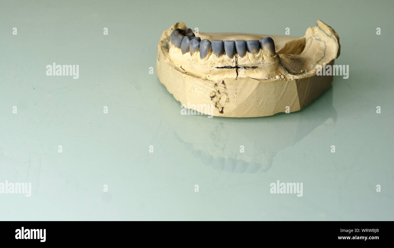 Cast of the lower jaw of a person. Dentures. Health care concept. Close ...