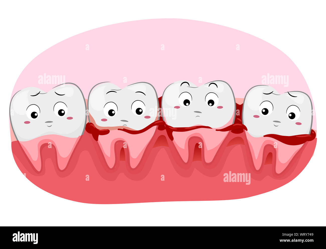 Illustration of Worried Teeth Mascots with Bleeding Gums Stock Photo ...