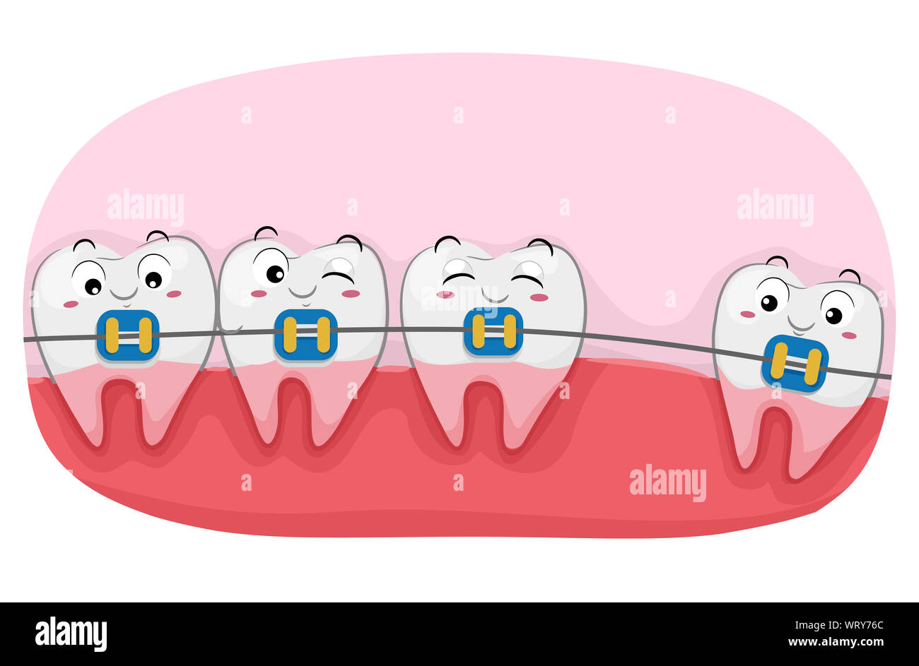 Illustration of Teeth Mascots with Big Space in Between Wearing Braces ...