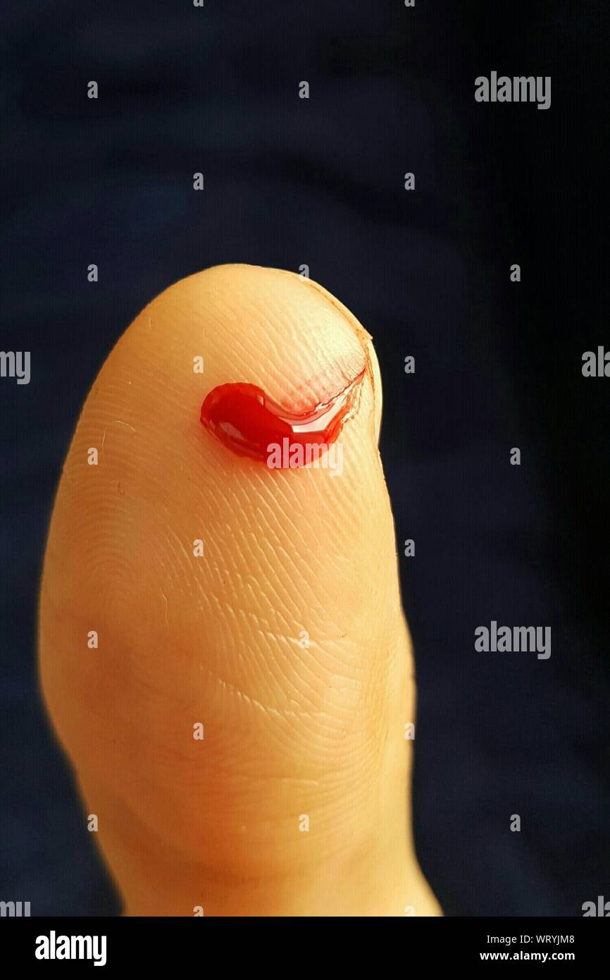 Injured person hi-res stock photography and images - Alamy