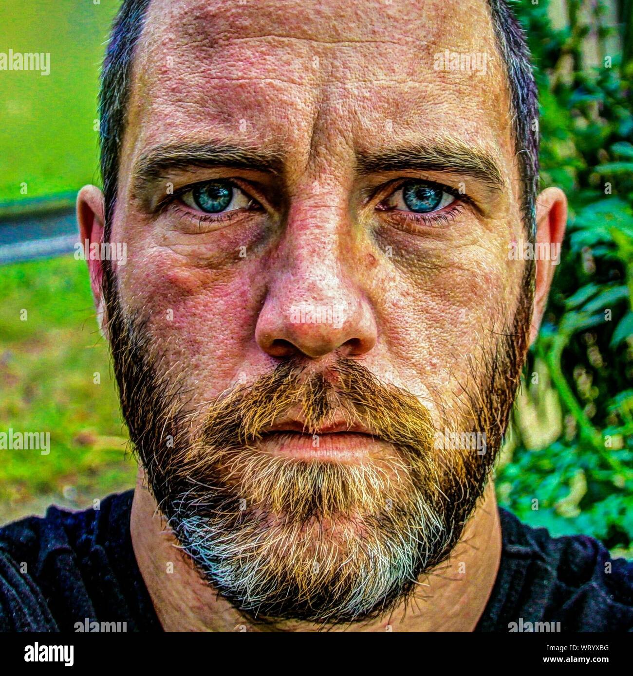Skin problem hi-res stock photography and images - Alamy Skin problem hi-res stock photography and images - Alamy