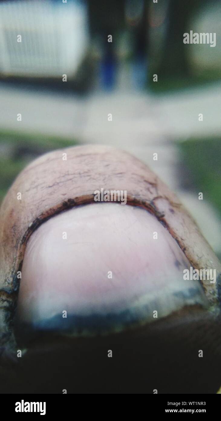 Fingernail hi-res stock photography and images - Alamy