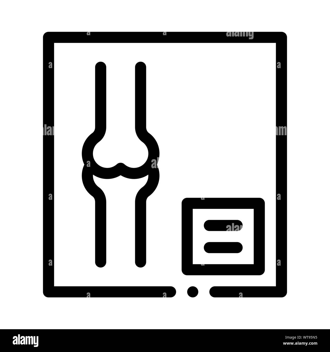 Bone X-ray Image Of Human Joints Orthopedic Vector Stock Vector Image ...