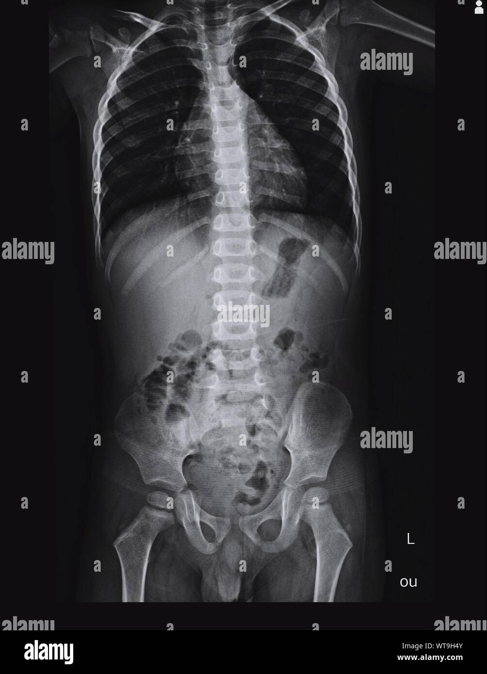 Medical x ray hi-res stock photography and images - Alamy