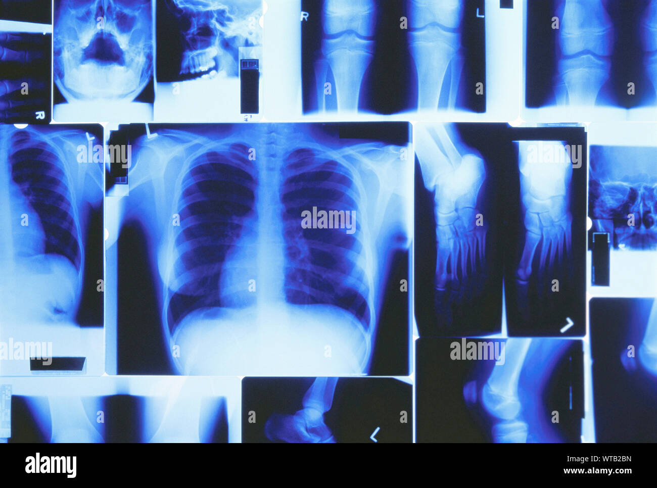 Composition of X-rays of parts of a Human Bocy Stock Photo - Alamy