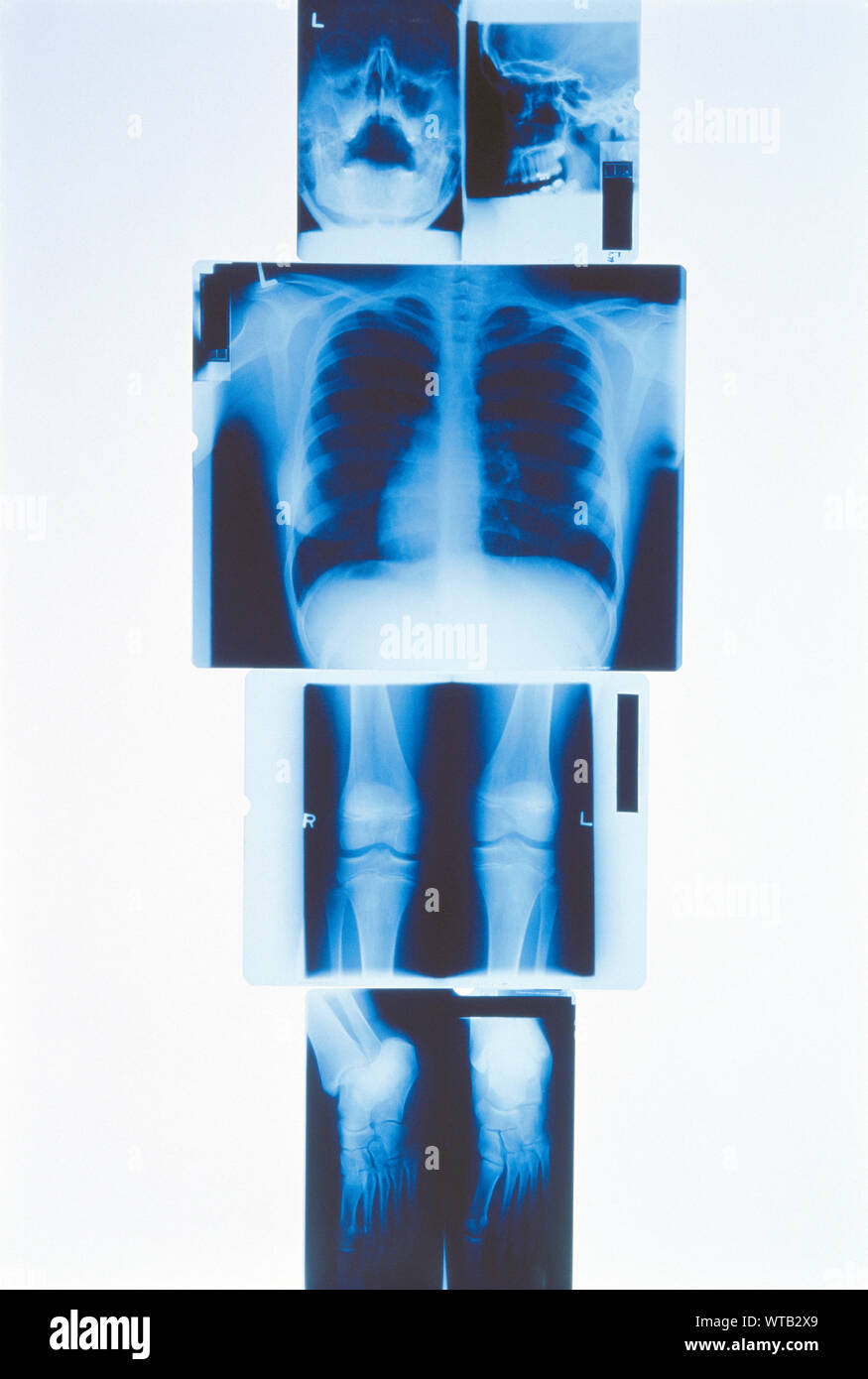 Composition of X-rays of parts of a Human Bocy Stock Photo - Alamy