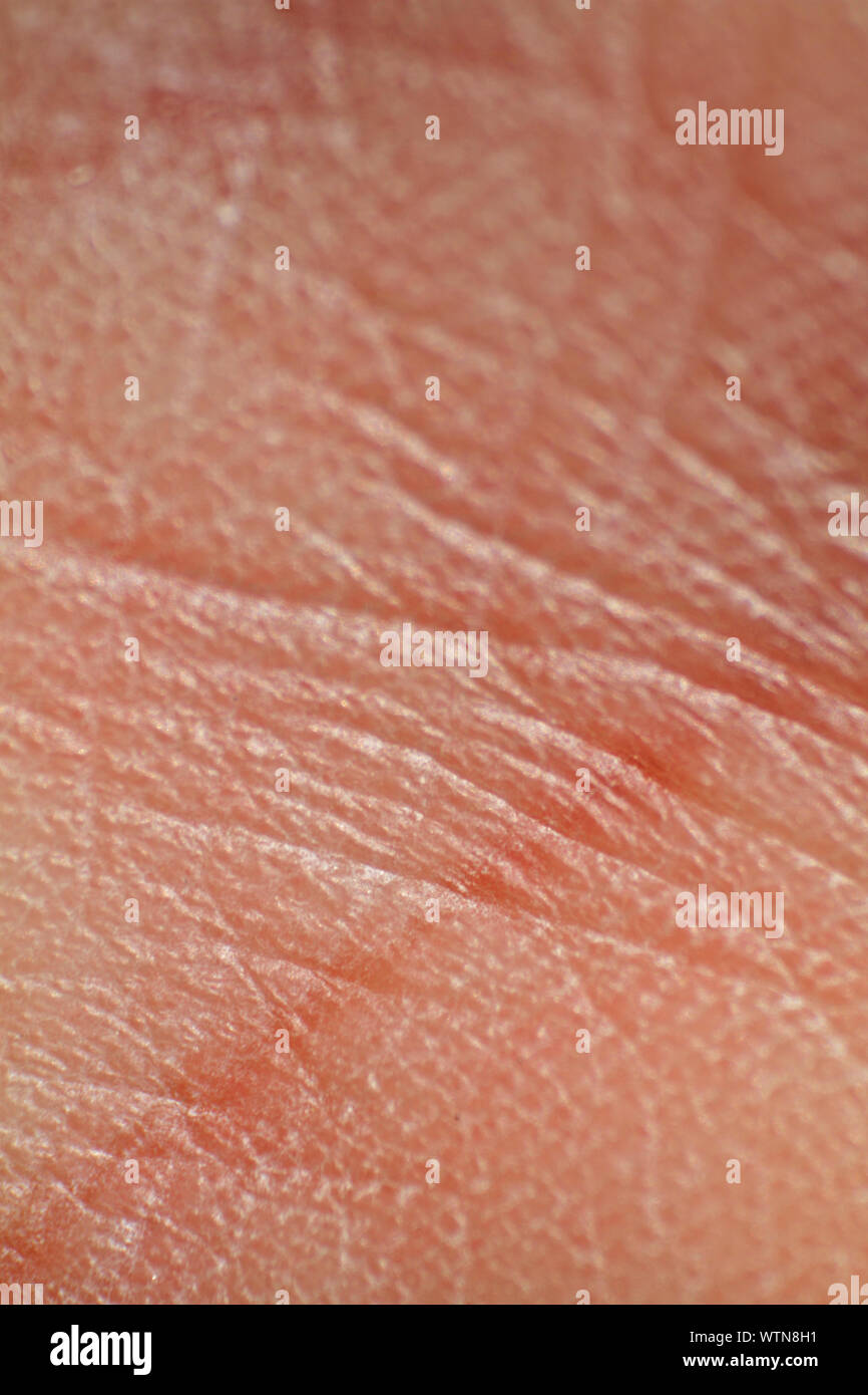 Human skin texture hi-res stock photography and images - Alamy