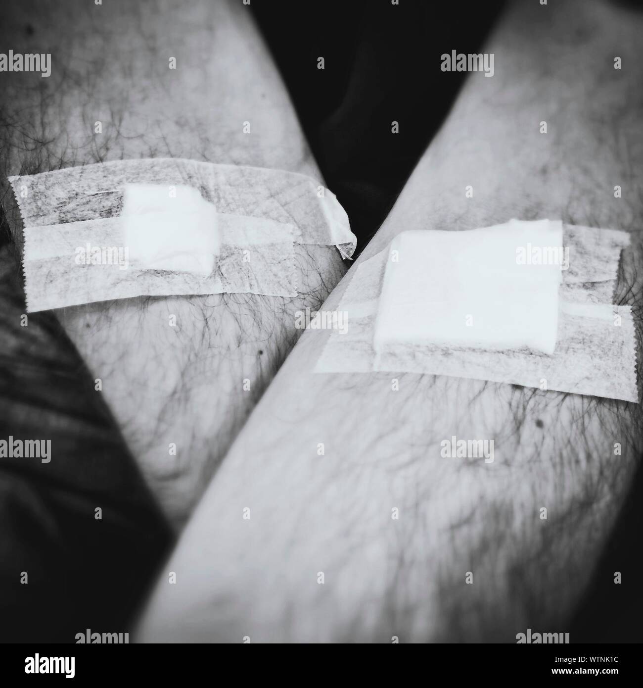 Bandaged hands hi-res stock photography and images - Alamy