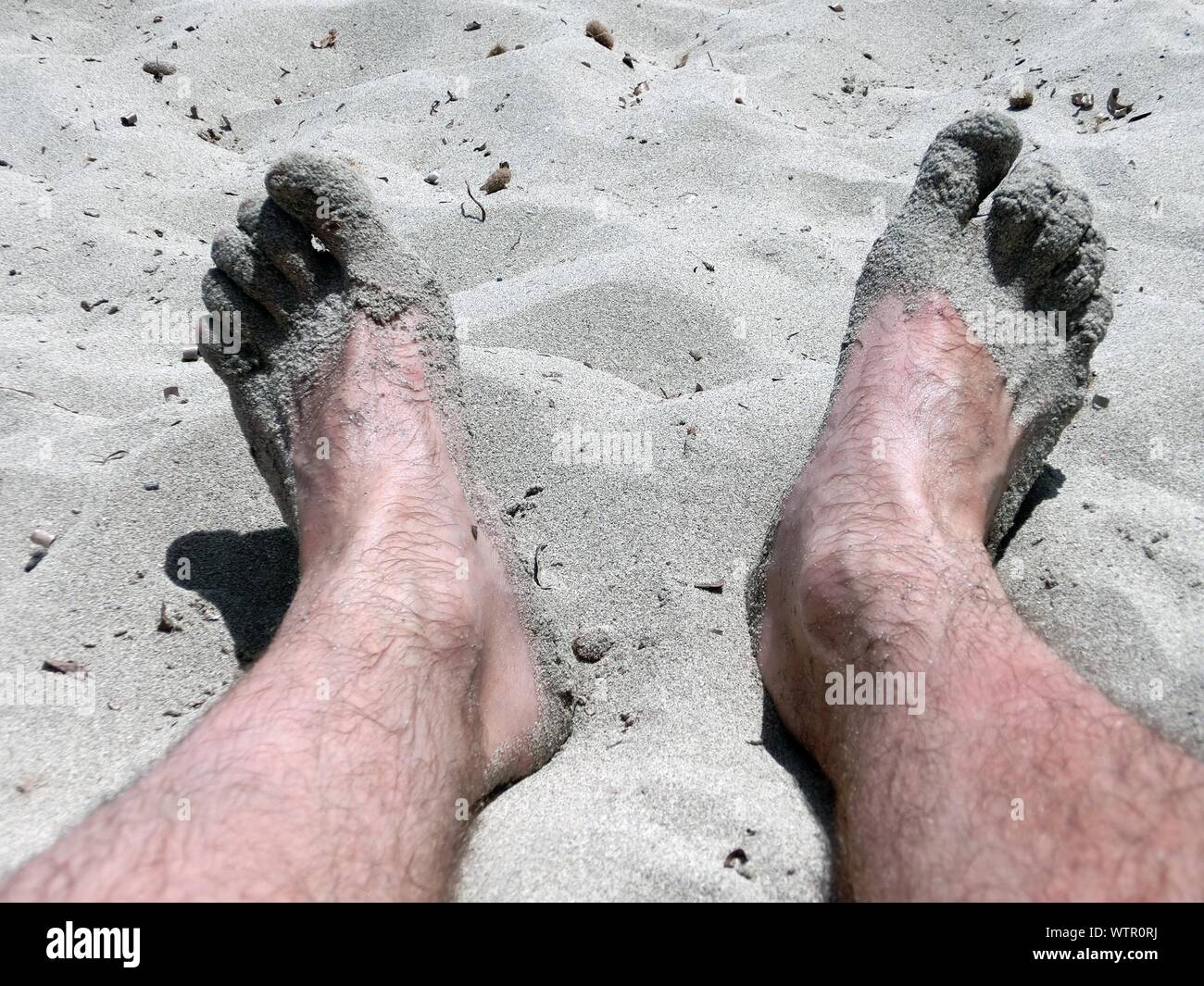 Dirty Legs High Resolution Stock Photography and Images - Alamy