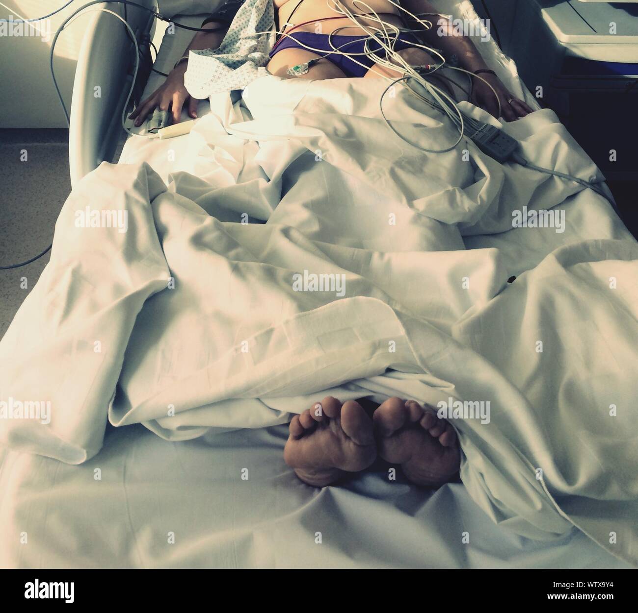 Leg on hospital bed hi-res stock photography and images - Alamy