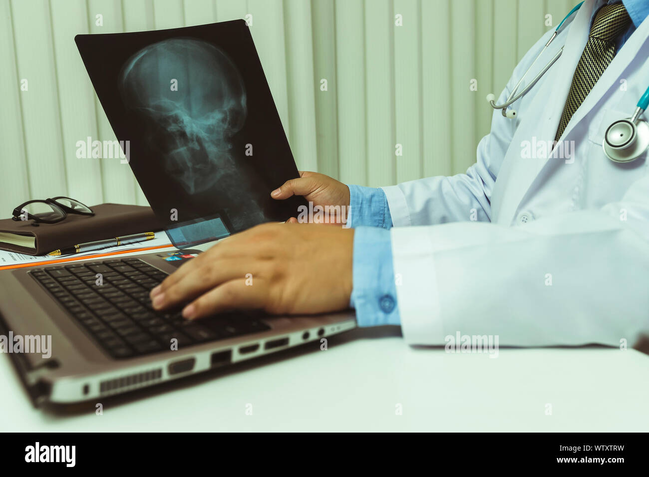 Doctor diagnose and analyze on x-ray film of patient Stock Photo - Alamy